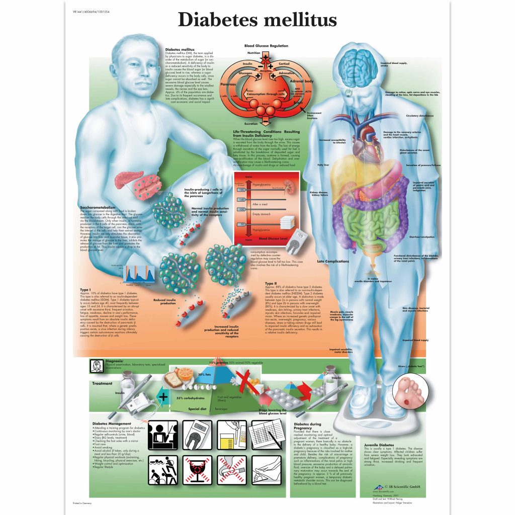 Diabetes Mellitus Chart - Modiezham Sdn Bhd